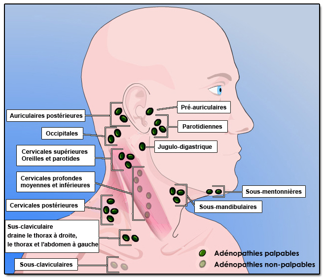 Ganglion Nuque Douloureux Et Gonfl XJGO Ganglion Nuque Douloureux Et Gonfl XJGO
